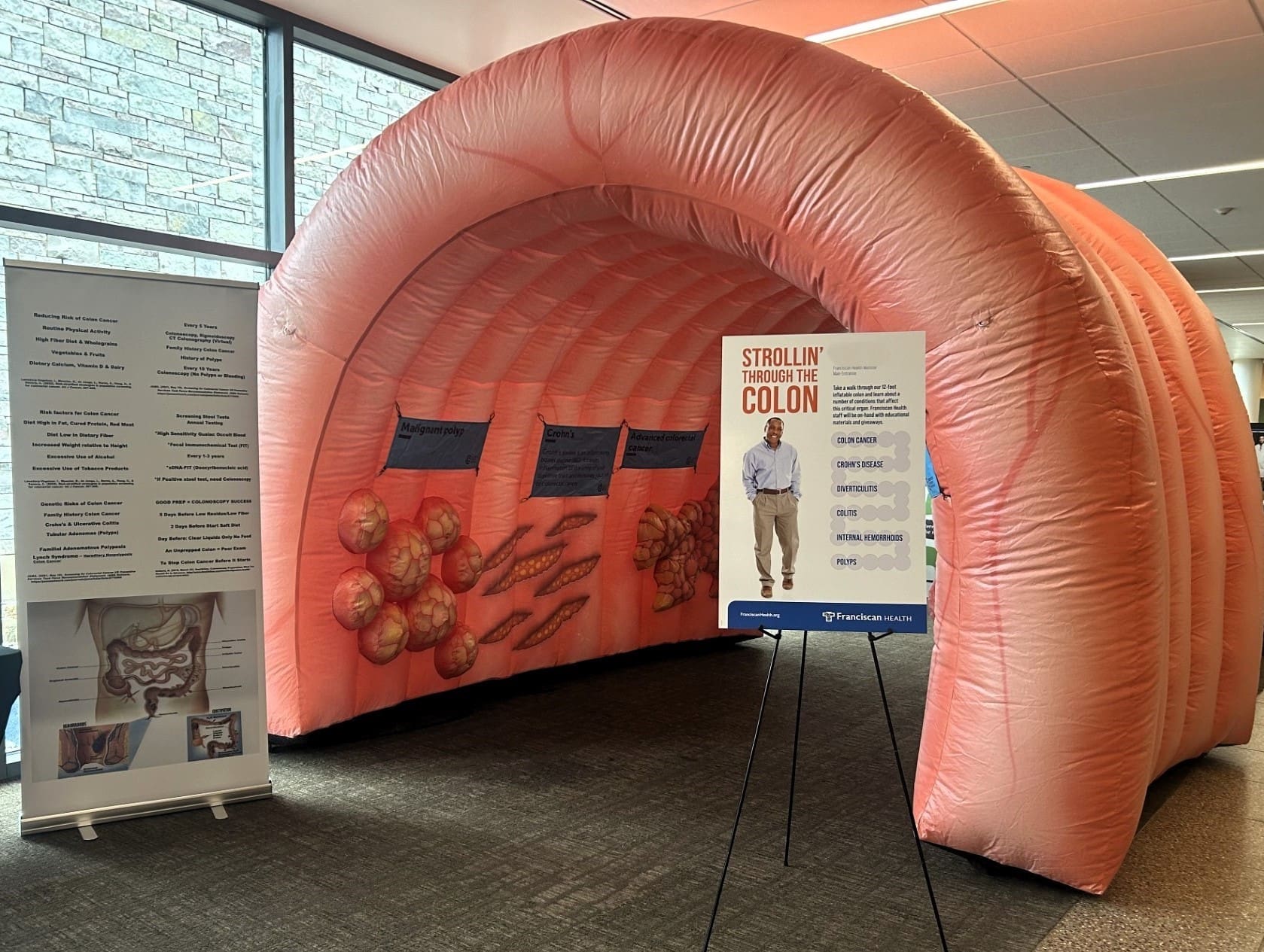 Walk-through inflatable colon to pop up at Franciscan Health Munster
